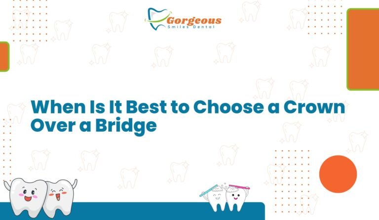 When Is It Best to Choose a Crown Over a Bridge | Gorgeous Smiles Dental